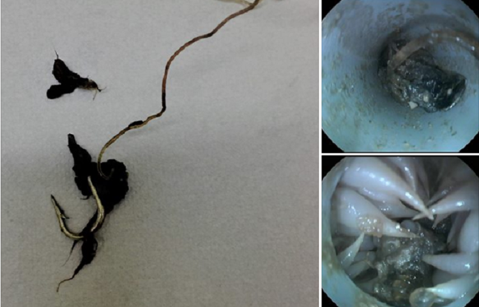 Fekruna li belgħet sunnara salvata b'apparat ġdid - TVMnews.mt