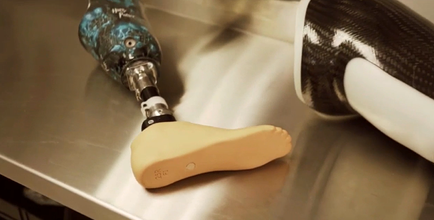 Maltese Professor in the UK working on innovative prosthetic services ...