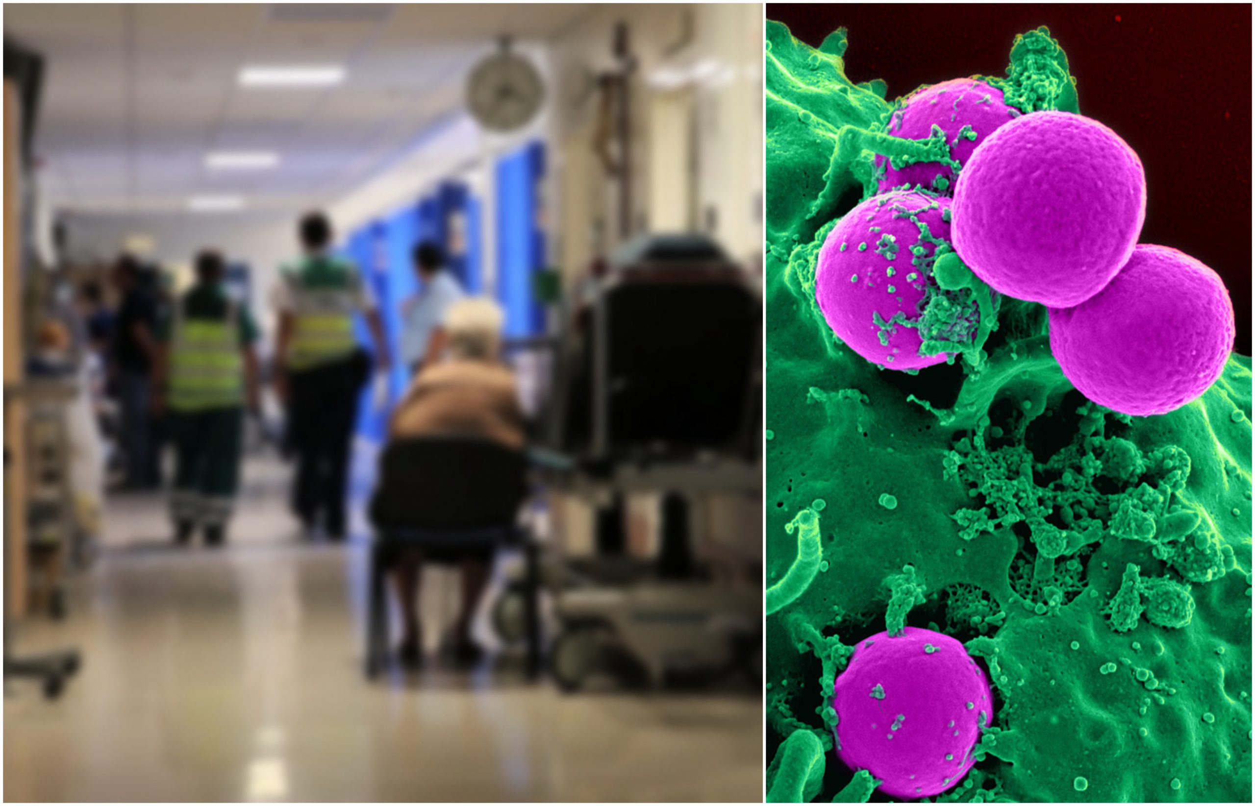 Maltese doctors find solution to the spread of MRSA in hospitals ...