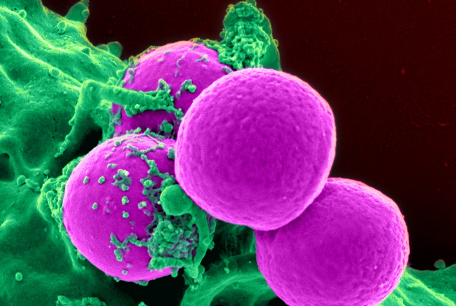 In 10 years, MRSA cases have gone down by ten times - TVMnews.mt