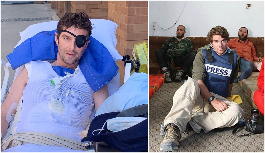 "I lost one eye and half a leg in Ukraine...I'm lucky to be alive ...
