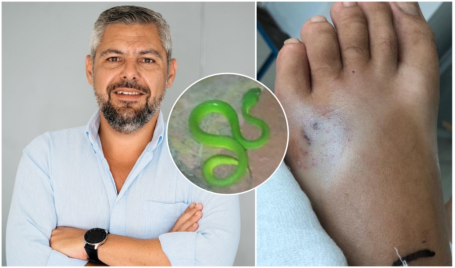 Maltese bitten by snake in Indonesia - feels lucky he did not suffer ...