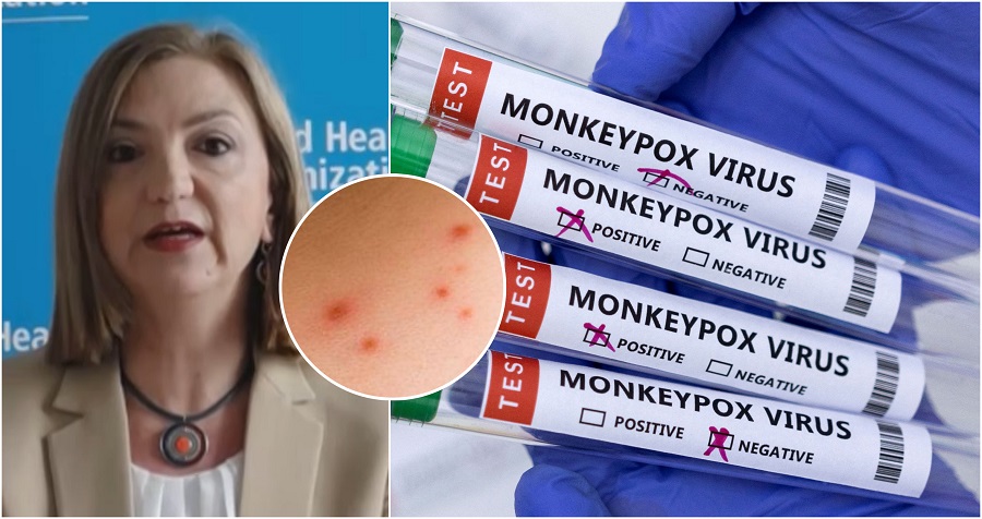 Watch: "Monkeypox symptoms include rash and blisters in genital area ...