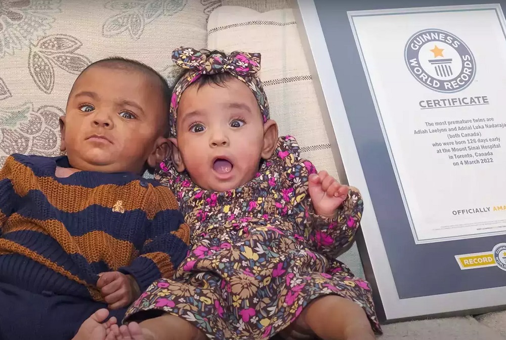 Certified as the world's youngest ever premature twins - TVMnews.mt